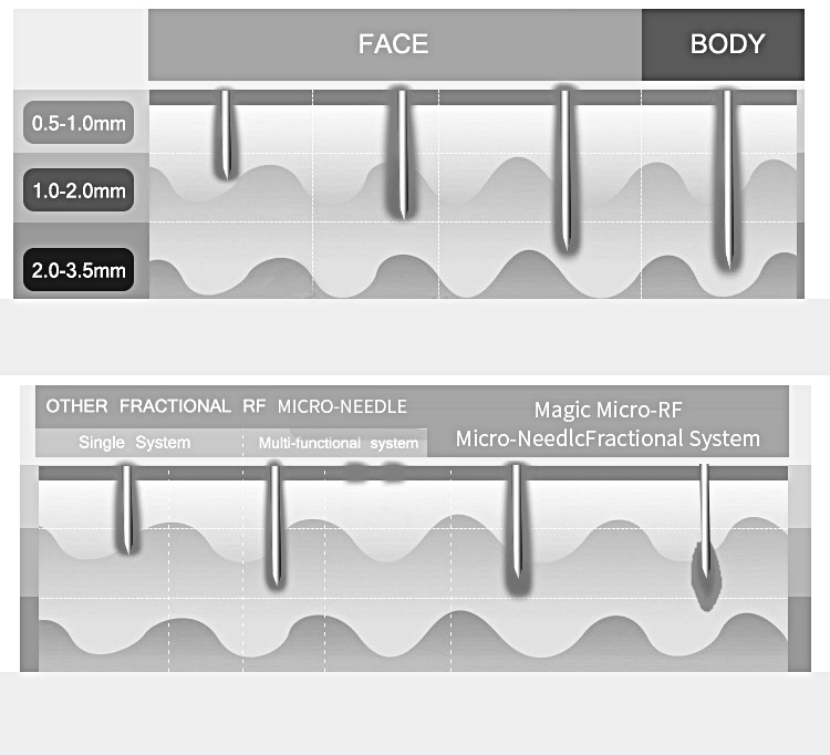 Portable Microneedle